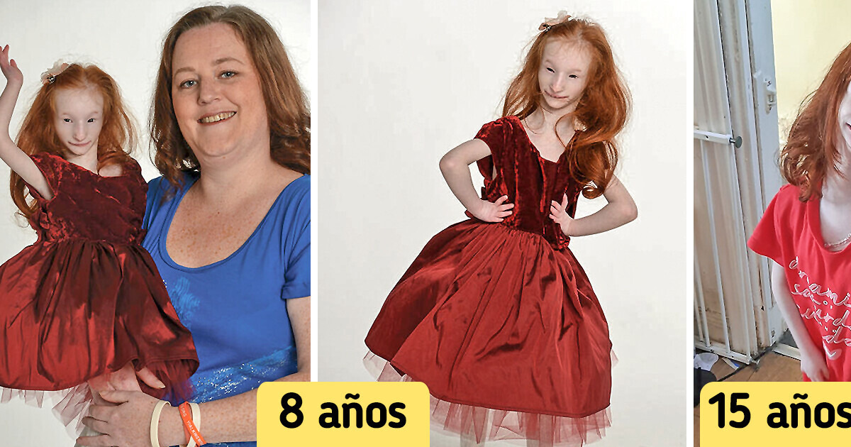 La inspiradora historia de “la niña más pequeña” que desafió a los médicos y celebró sus 16 años ...